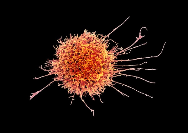 July 2017 Cord Blood Developments and News | Cryo-Cell